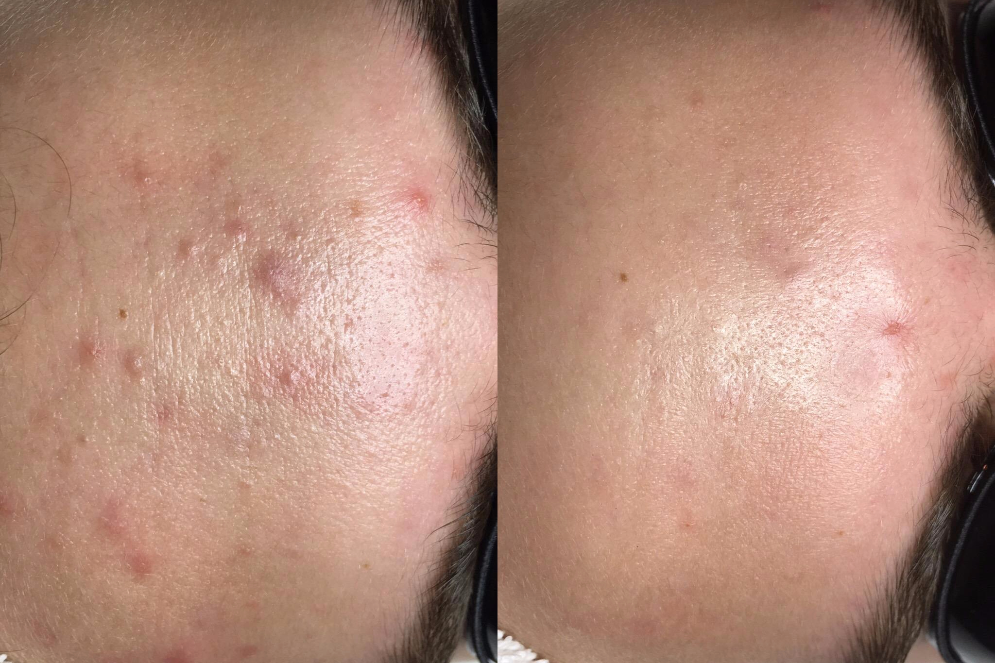 Grafin Skin And Beauty In Oakbrook Terrace IL | Vagaro